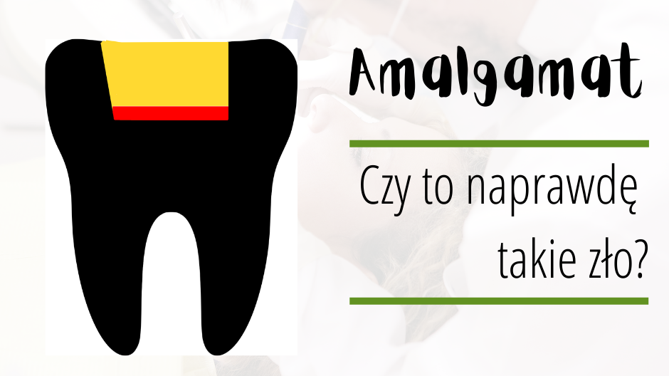 Amalgamat - czy to naprawdę takie zło? – Będąc Młodym Dentystą